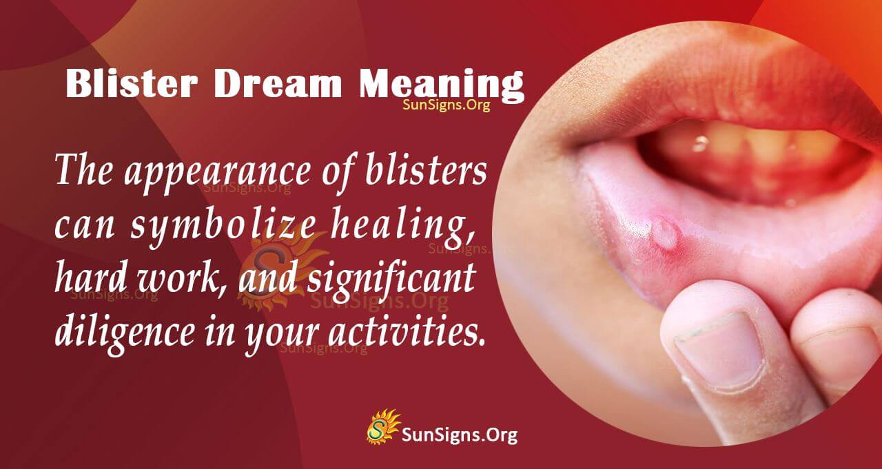 Seeing A Blister In Your Dream - Meaning, Interpretation And Symbolism - SunSigns.Org